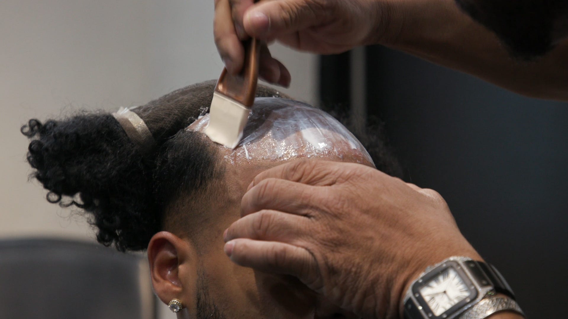 Hair Replacement For Men Hair Restoration Experts